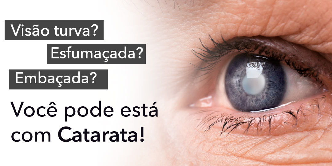 Catarata: Reconheça os Sintomas e Não Deixe sua Visão Apagar! - Dra ...