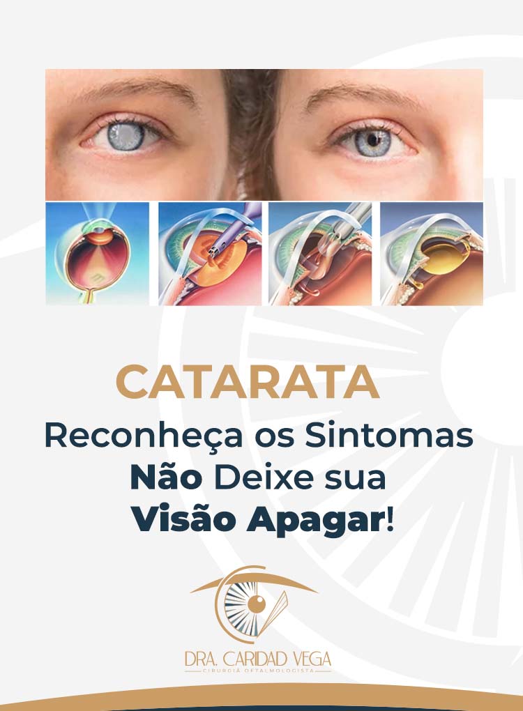 Catarata: Reconheça os Sintomas e Não Deixe sua Visão Apagar! - Dra ...